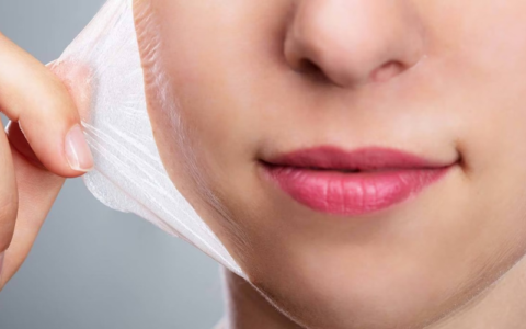 5 Benefits Of Perfect Derma Peel